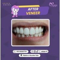 Layanan di Klinik Gigigo Dental Care