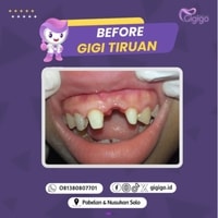 Layanan di Klinik Gigigo Dental Care