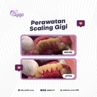 Layanan di Klinik Gigigo Dental Care