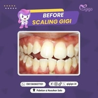 Layanan di Klinik Gigigo Dental Care
